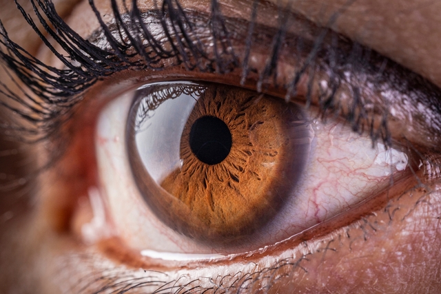 Experts Of Glaucoma Treatment In The South West| The Eye Unit | The Eye ...